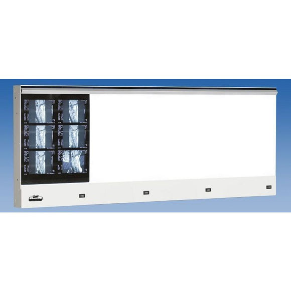 The Liberator Viewbox / 4 in 1 Horizontal (4 Bulb) by Wolf X-Ray – Pure Spa Direct